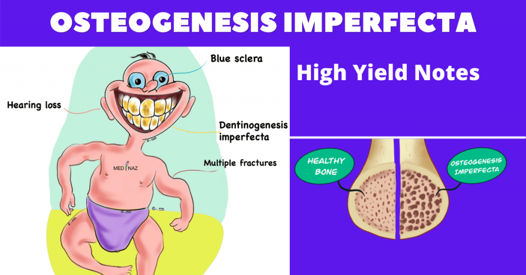 Osteogenesis Imperfecta - Medinaz HighYield Notes
