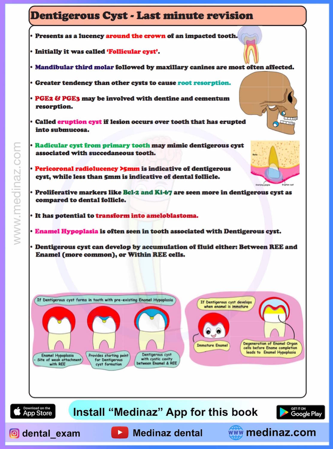 Dentigerous Cyst Oral Pathology Notes - Medinaz Blog