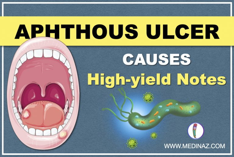 Aphthous Ulcer Causes - High-yield Dental Notes - Medinaz Blog