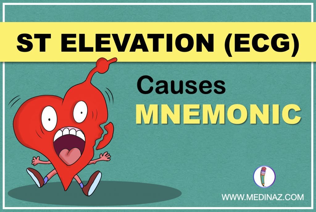 ST segment elevation mnemonic (ECG) - Medinaz Blog