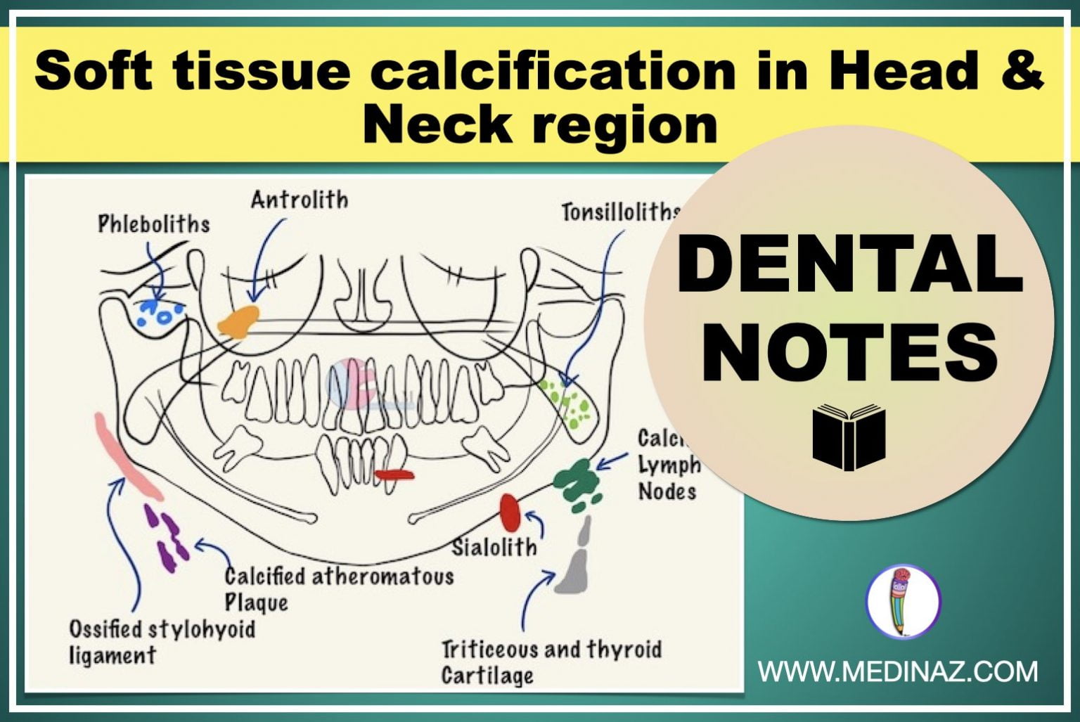 Soft tissue calcification in Head & Neck region - Classification
