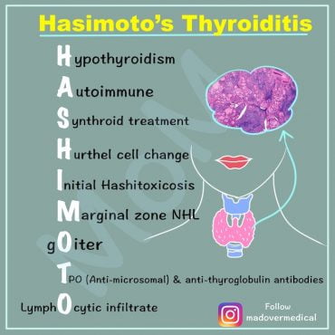Hashimoto's thyroiditis Mnemonic