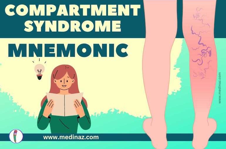 DiGeorge syndrome mnemonic - CATCH-22 - Medinaz Blog