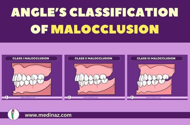 Soft tissue calcification in Head & Neck region - Classification