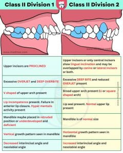 ANGLE’S CLASSIFICATION MALOCCLUSION - Dental Notes