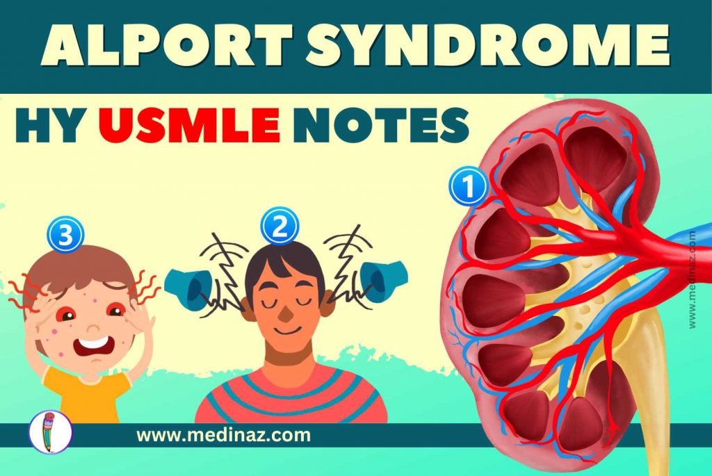 Alport Syndrome USMLE Notes