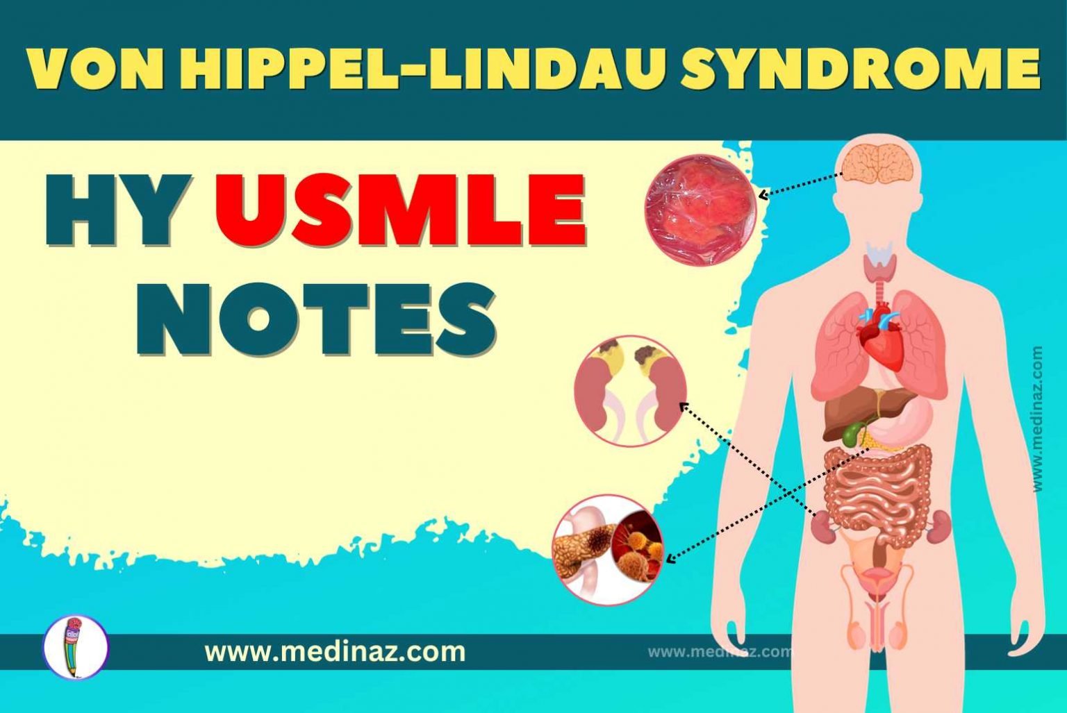 Von Hippel-Lindau Syndrome USMLE Notes