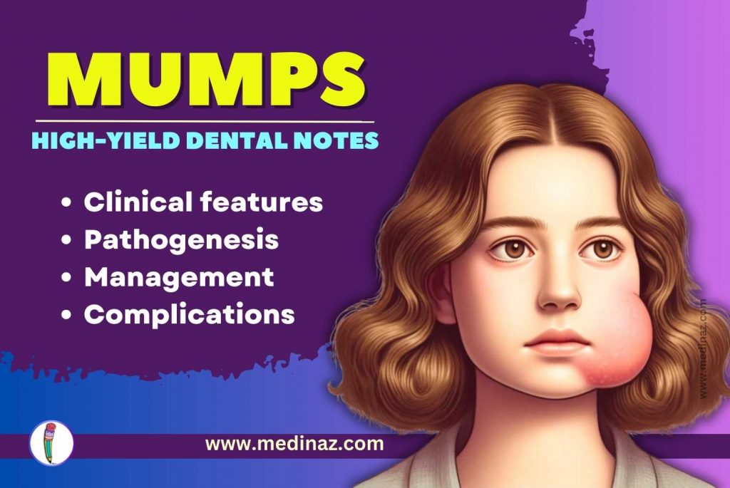 Mumps: Highyield Dental Notes - Medinaz Blog