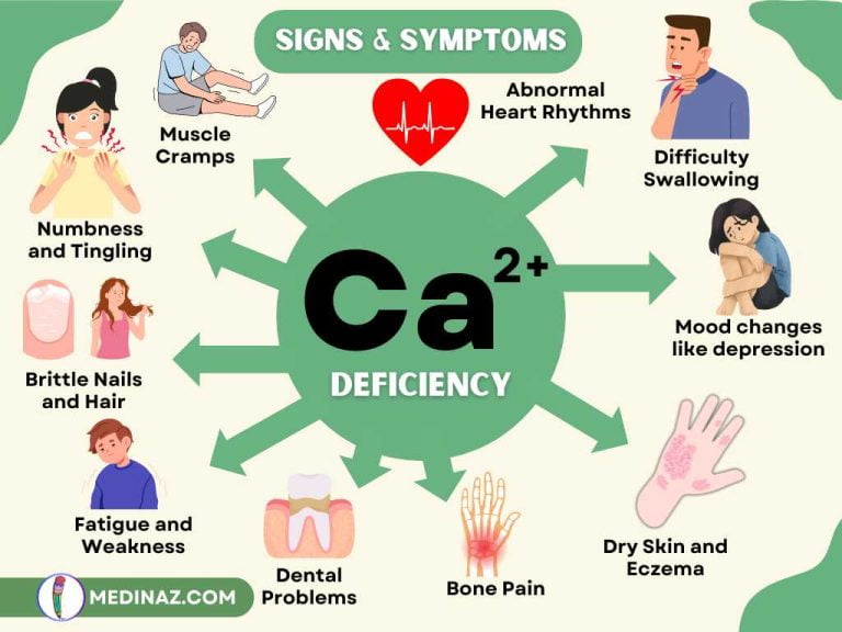 Top 10 Calcium Deficiency Symptoms: Recognize the Signs Early