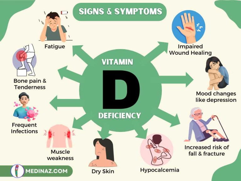 Top 10 Vitamin D Deficiency Symptoms: What You Need to Know